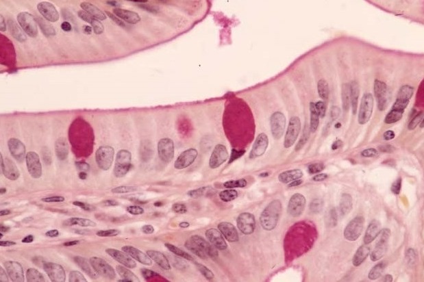 Histología – Técnica de Schiff (PAS)